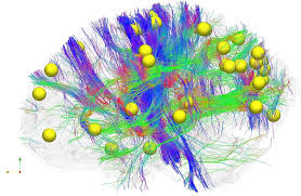 O is for Overstimulated brain (ABCW) - Ramblin' with Roger